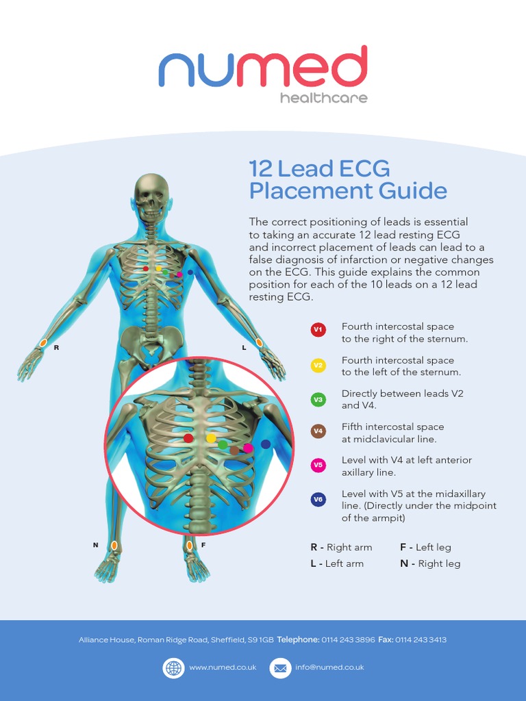 12 Lead ECG Placement Guide | PDF | Cardiology
