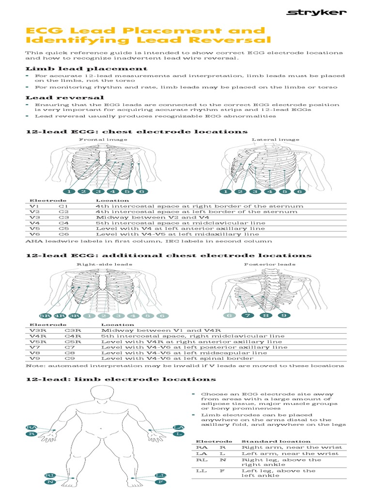 ECG Lead Placement and Identifying Lead Reversal | PDF ...