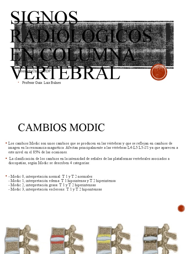 Signos Radiologicos en Columna Vertebral: Internado Clínico UDP ...