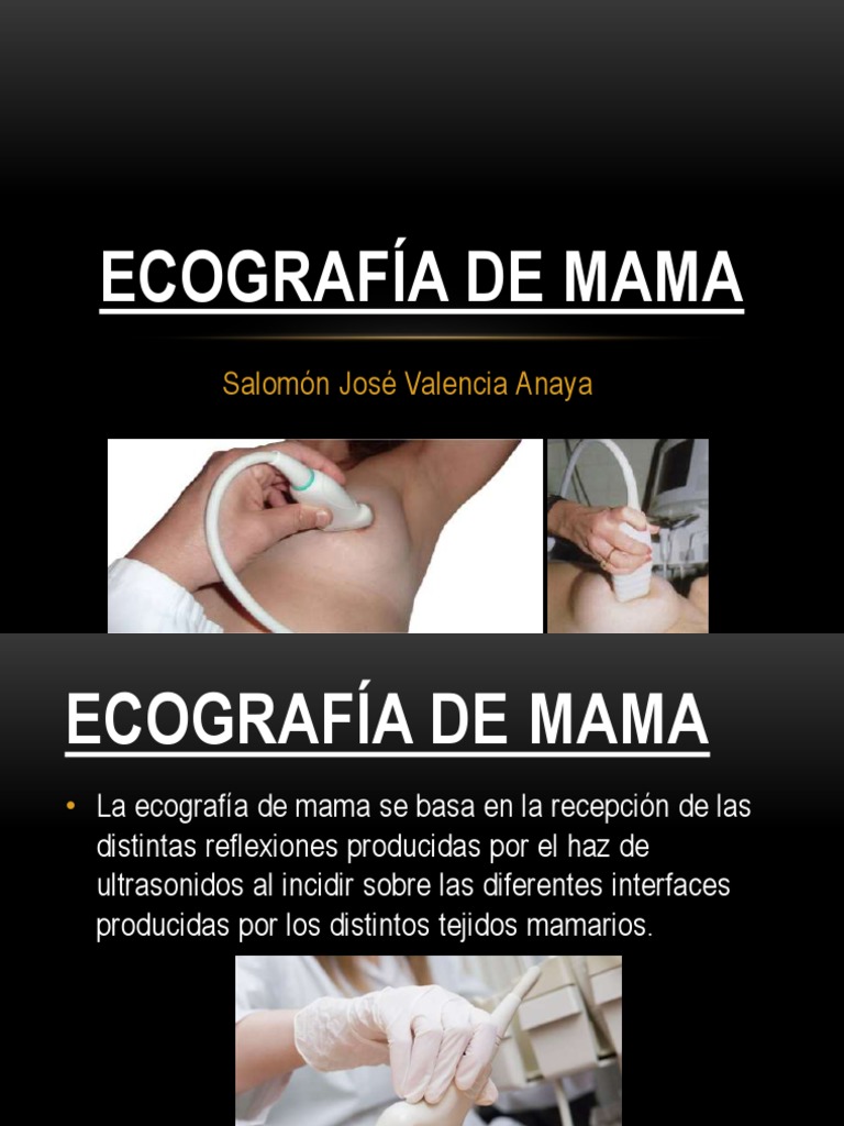 Ecografía de Mamas | PDF | Ultrasonido médico | Cáncer de mama