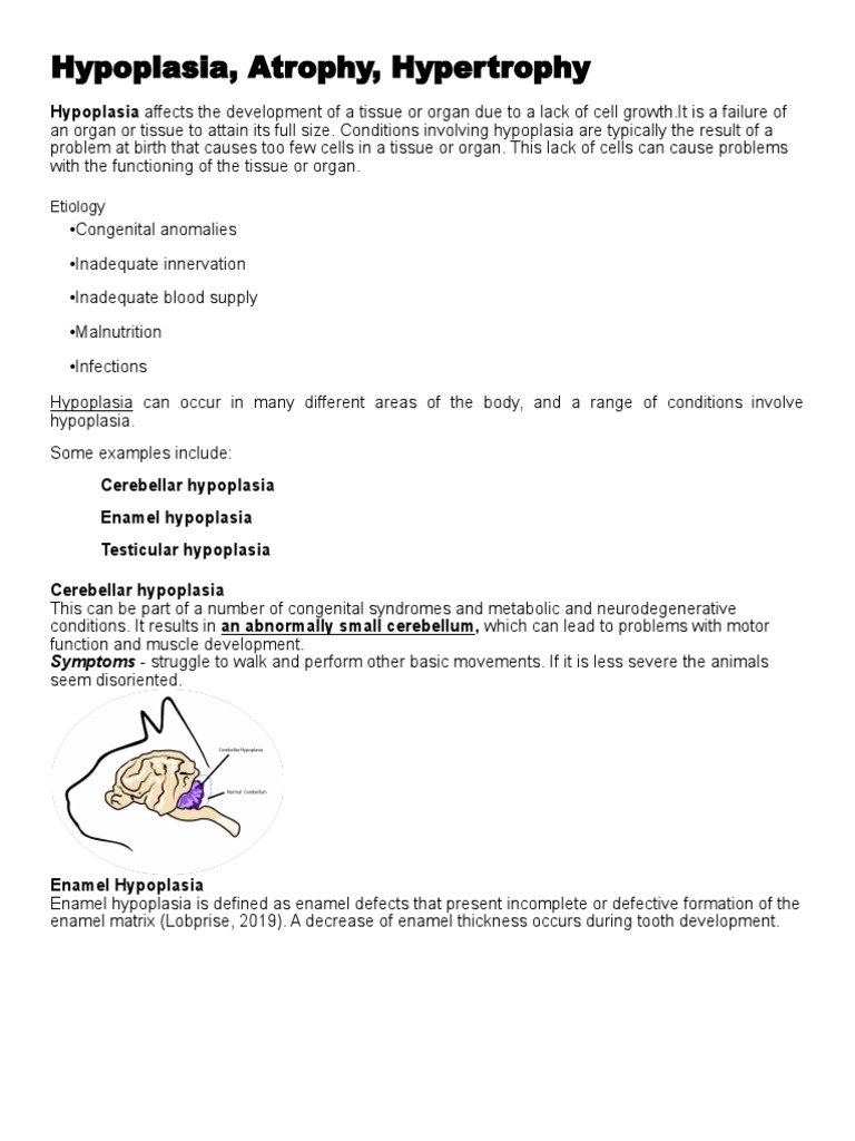 Hypoplasia Atrophy Hypertrophy | PDF | Atrophy | Tooth Enamel