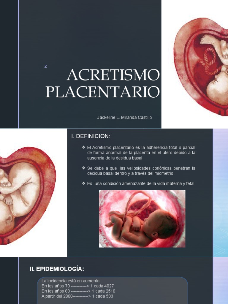 Acretismo Placentario | PDF | Placenta | Parto