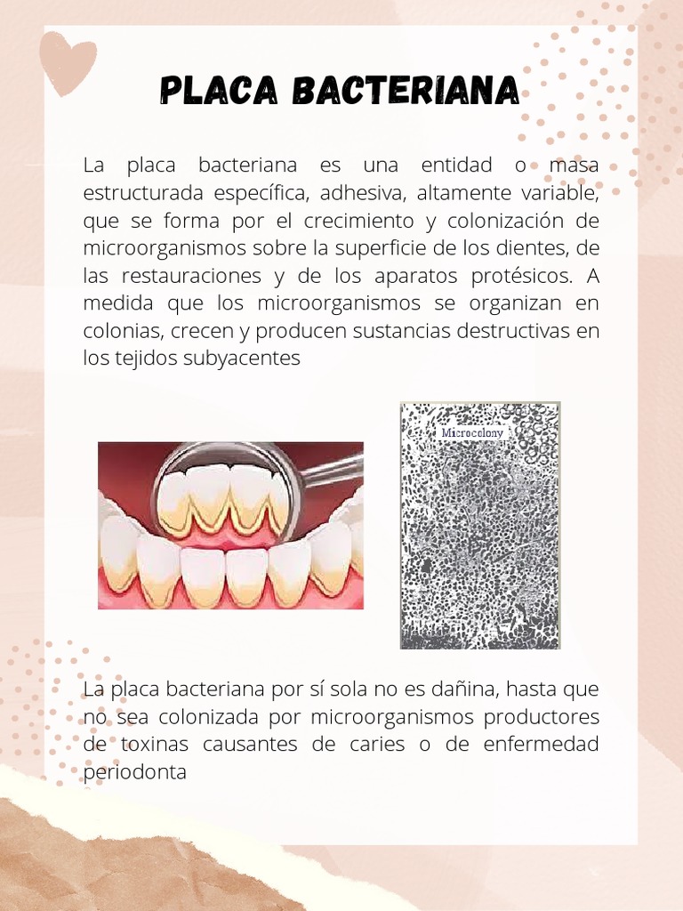 Resumen Placa Bacteriana Periodoncia | PDF