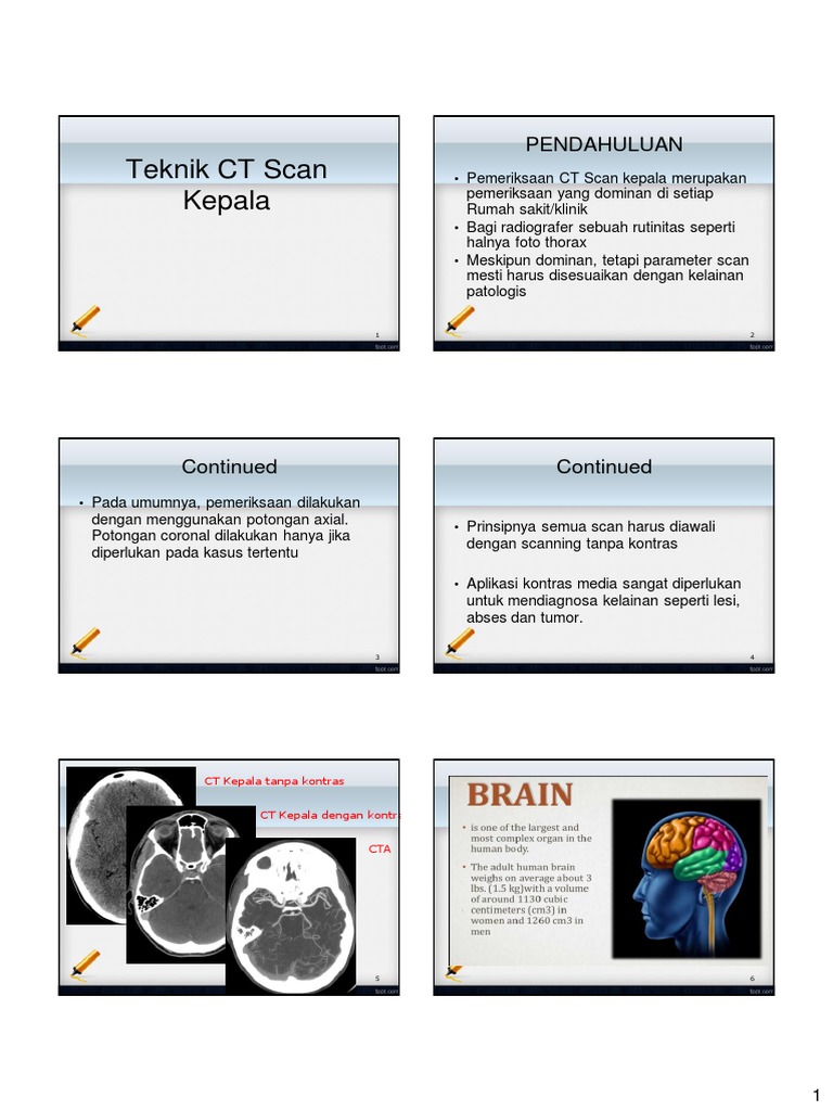 Teknik CT Scan Kepala | PDF