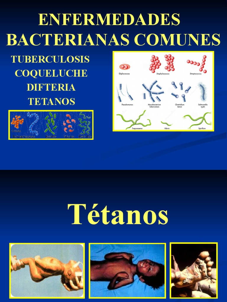 Enfermedades Bacterianas Comunes: Tuberculosis Coqueluche Difteria Tetanos | PDF | Medicina ...