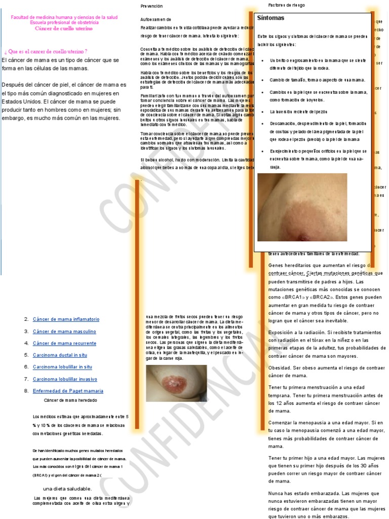 Triptico Cancer de Mama | Descargar gratis PDF | Cáncer de mama ... Triptico Cancer de Mama | Descargar gratis PDF | Cáncer de mama ...