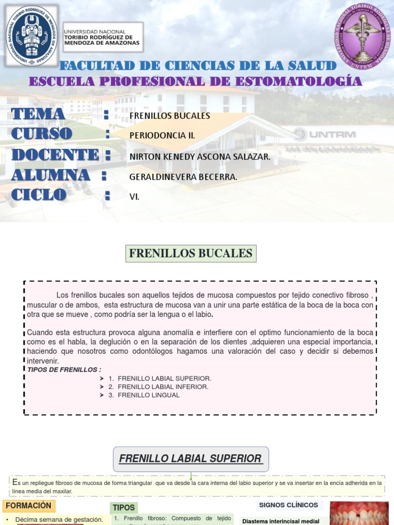 Tipos y tratamiento de frenillos bucales | PDF | Odontología | Boca