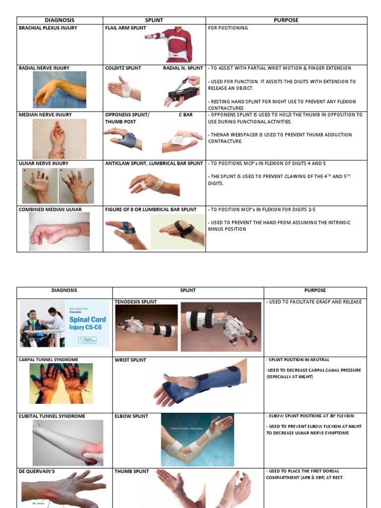 Median Nerve Injury Splint