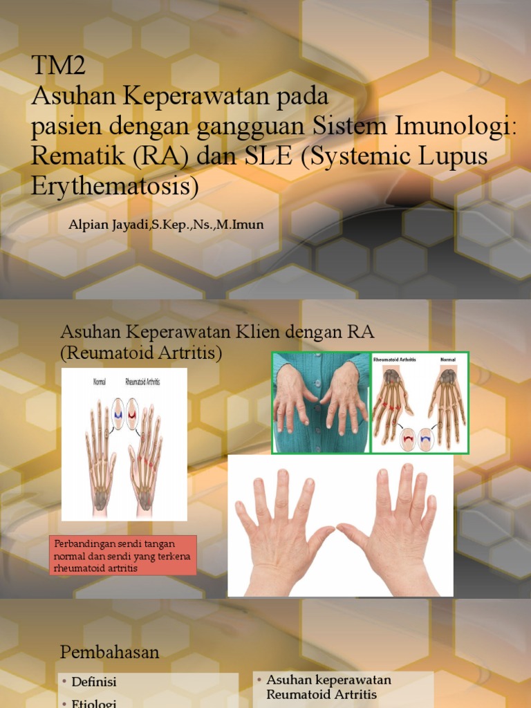 Asuhan Keperawatan untuk RA dan SLE | PDF
