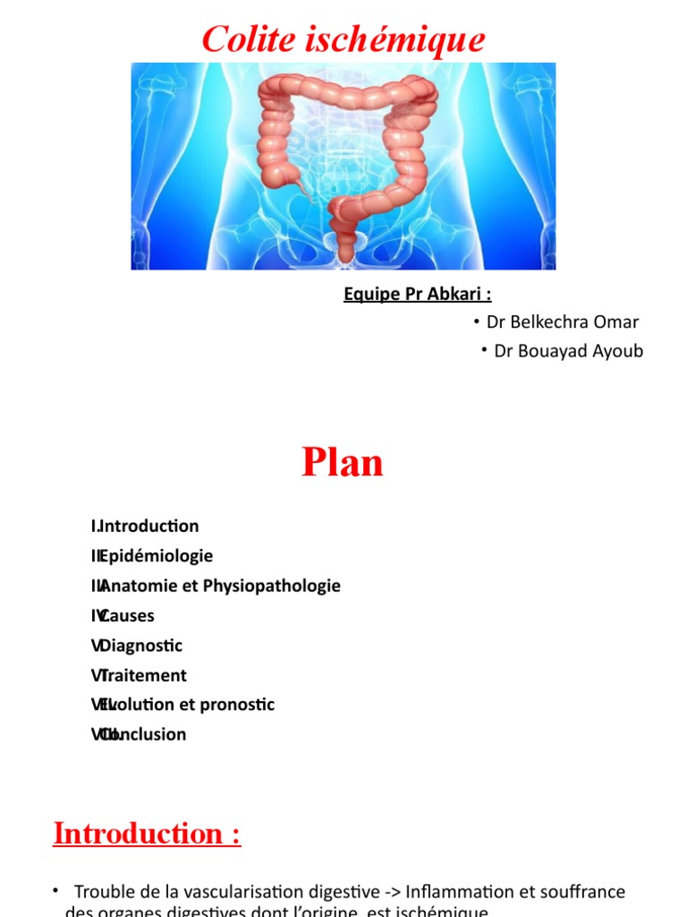 Colite Ischémique: Equipe PR Abkari: - DR Belkechra Omar - DR Bouayad ...