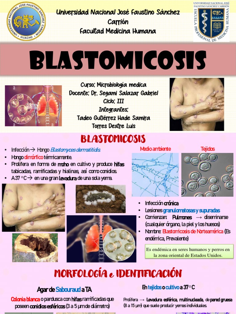 Blastomicosis: Universidad Nacional José Faustino Sánchez Carrión Facultad Medicina Humana | PDF ...