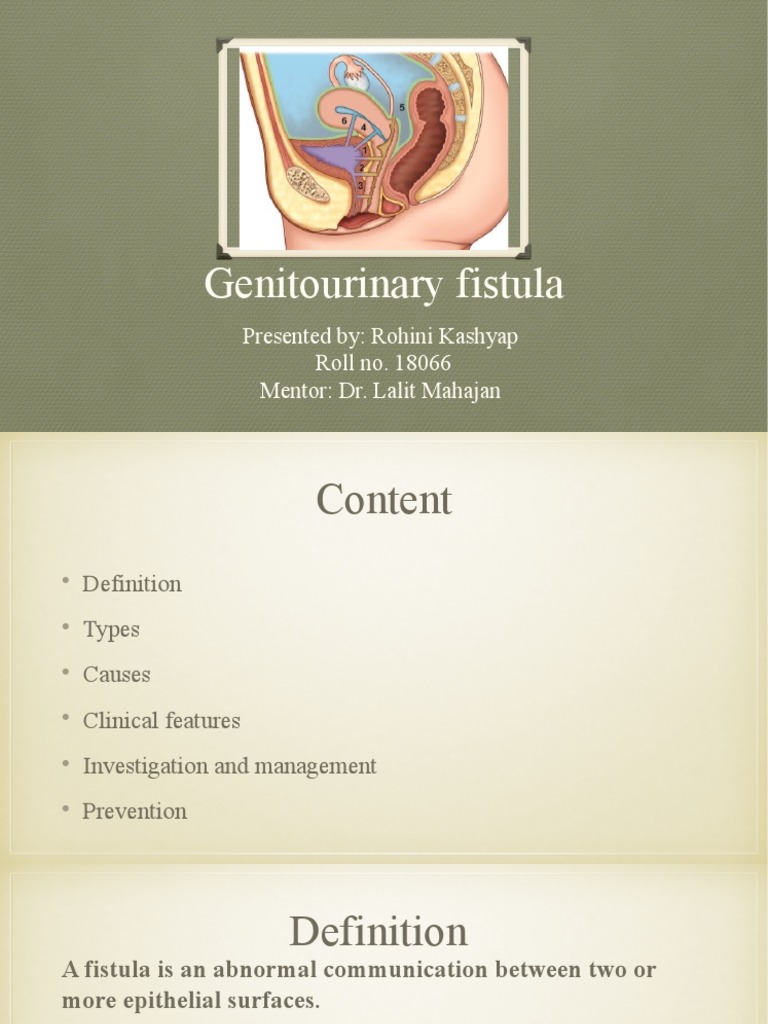 Genitourinary Fistula Overview | PDF | Vagina | Surgical Suture