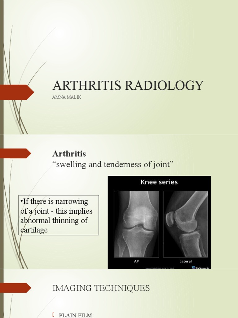 Arthritis Radiology | PDF | Osteoarthritis | Vertebra