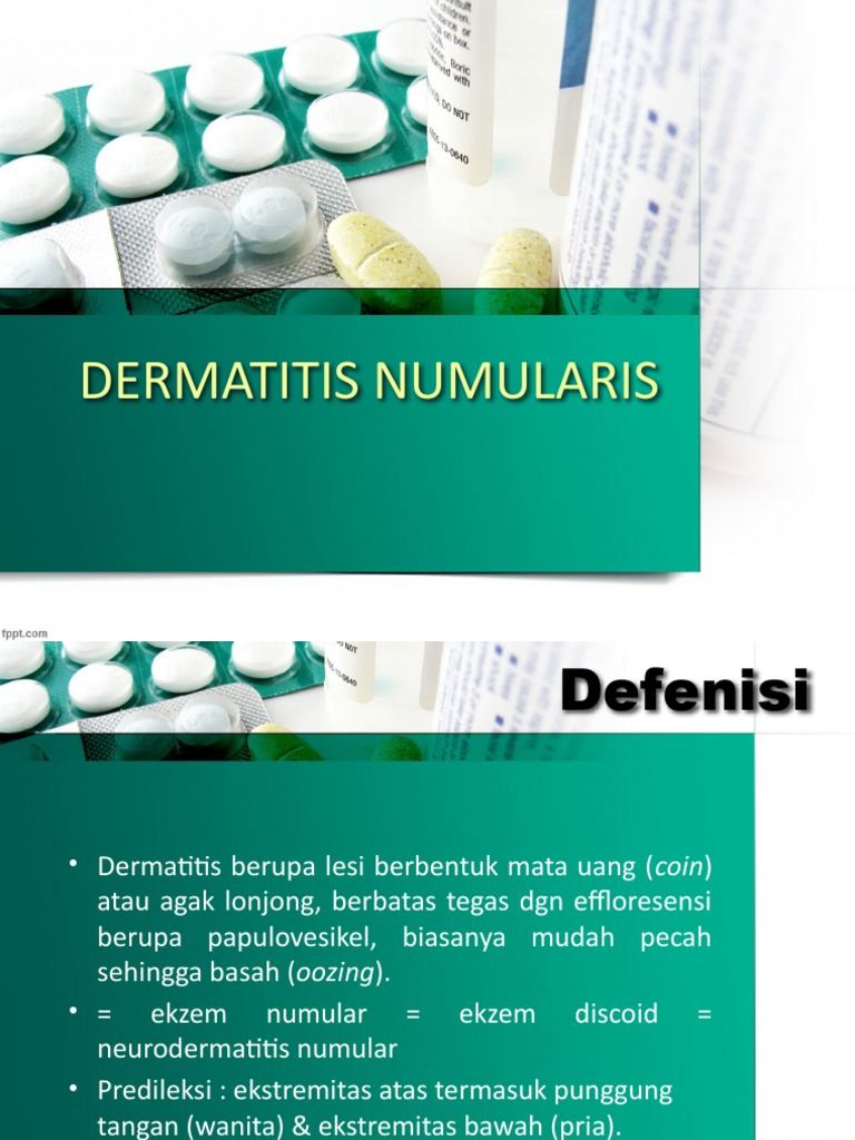 Dermatitis Numularis | PDF