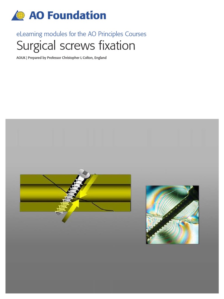 Surgical Screws Fixation: Elearning Modules For The Ao Principles ...