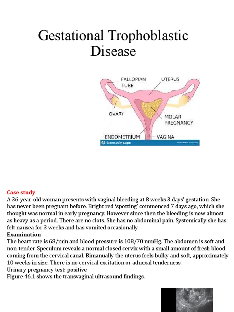 Gestational Trophoblastic Disease | PDF | Pregnancy | Medical Specialties