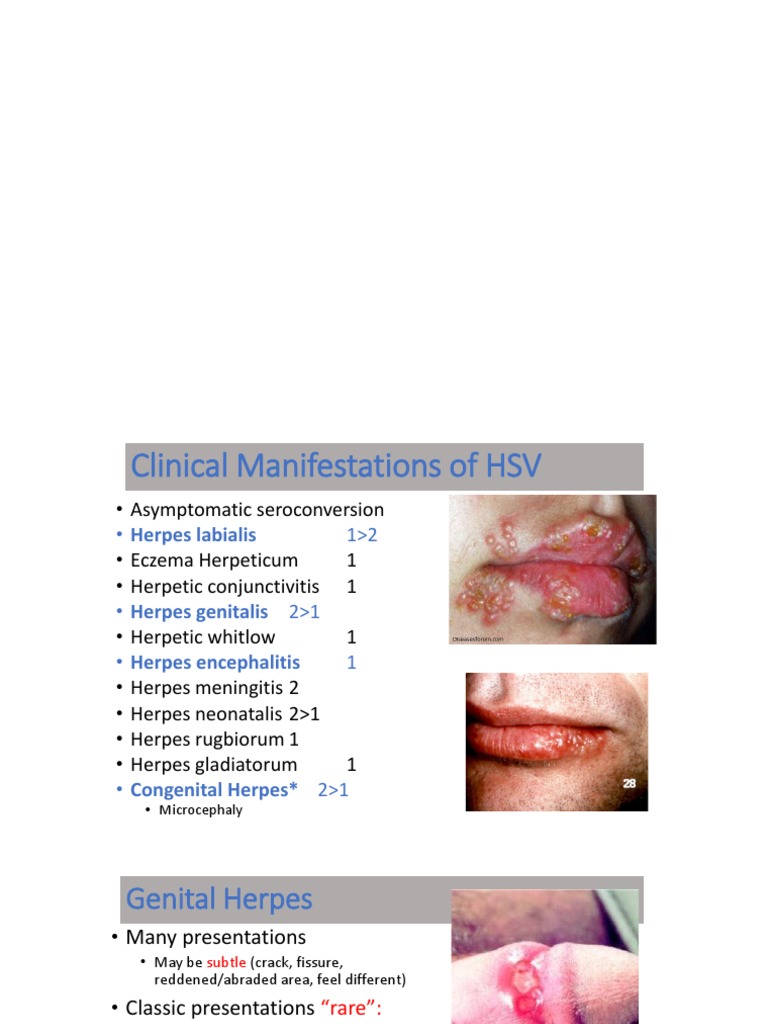Herpes Simplex Virus Clinical Manifestations and Genital Herpes | PDF