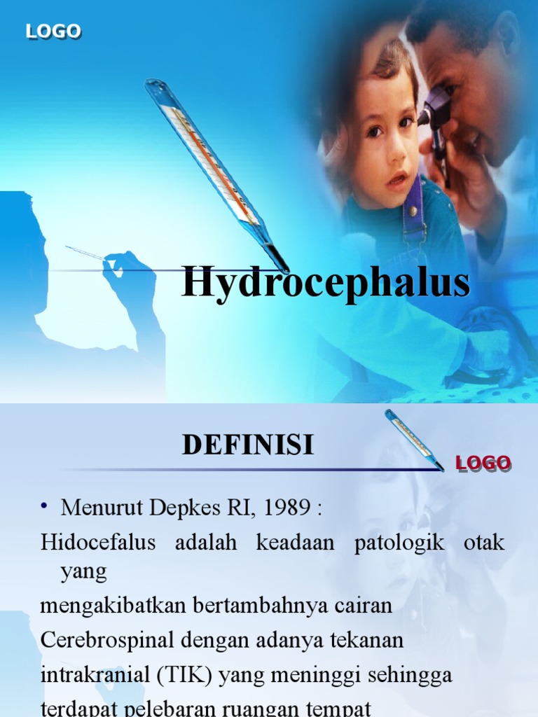 Hydrocephalus | PDF