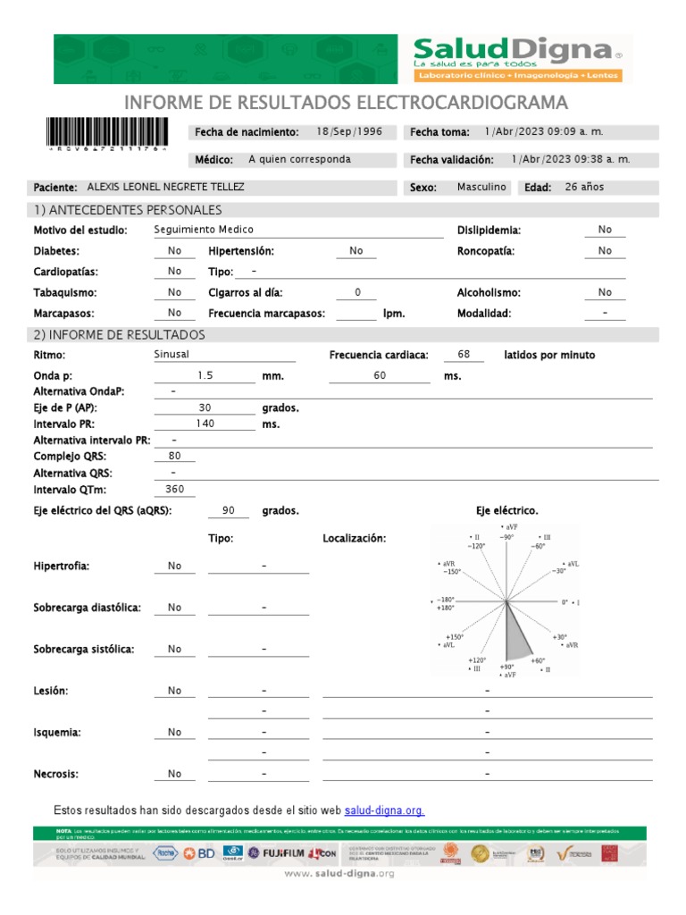 Informe de Resultados Electrocardiograma: 1) Antecedentes Personales ...