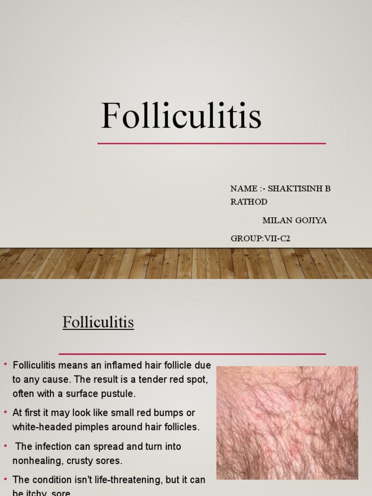 Folliculitis: Name:-Shaktisinh B Rathod Milan Gojiya Group:Vii-C2 | PDF