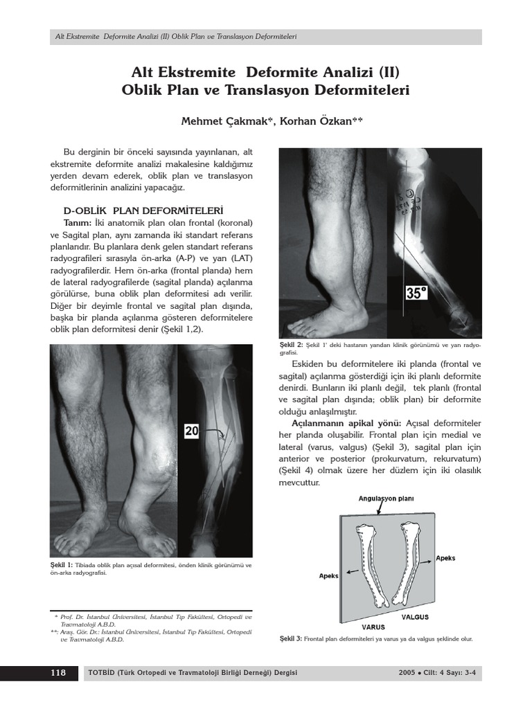 Alt Ext Defor Anal2 | PDF