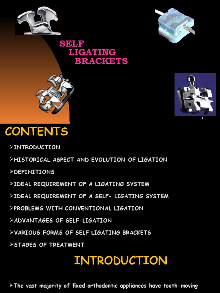 Self Ligating Brackets | PDF | Orthodontics | Dentistry Branches