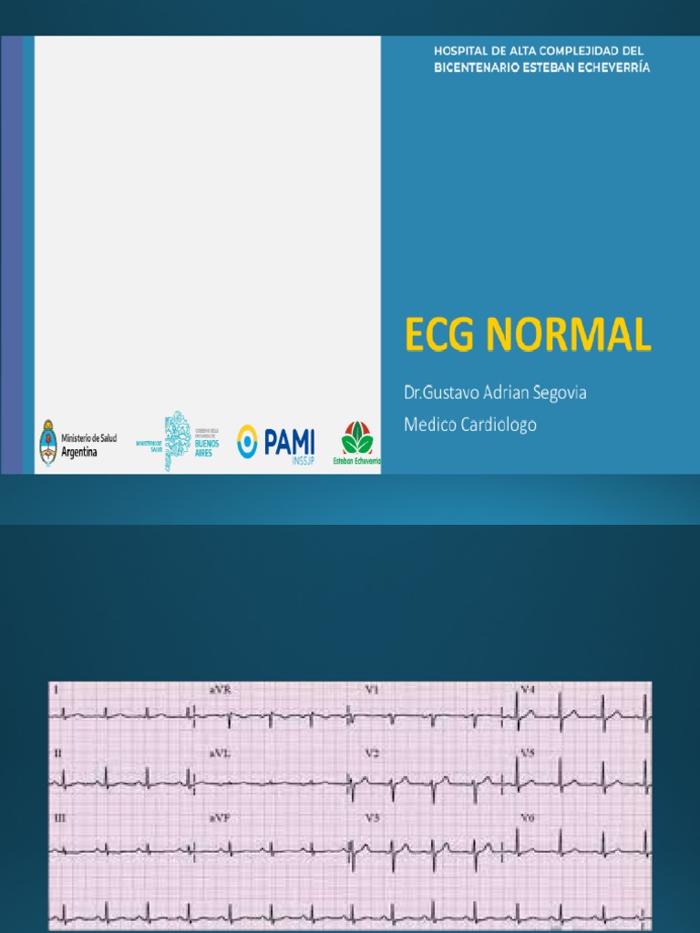 ECG Normal: Guía para Residentes | PDF | Electrocardiografia ...