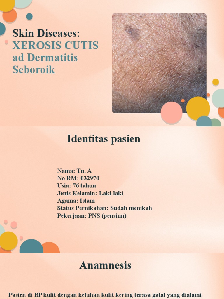 Diagnosis dan Penanganan Xerosis Cutis | PDF | Pengembangan Diri