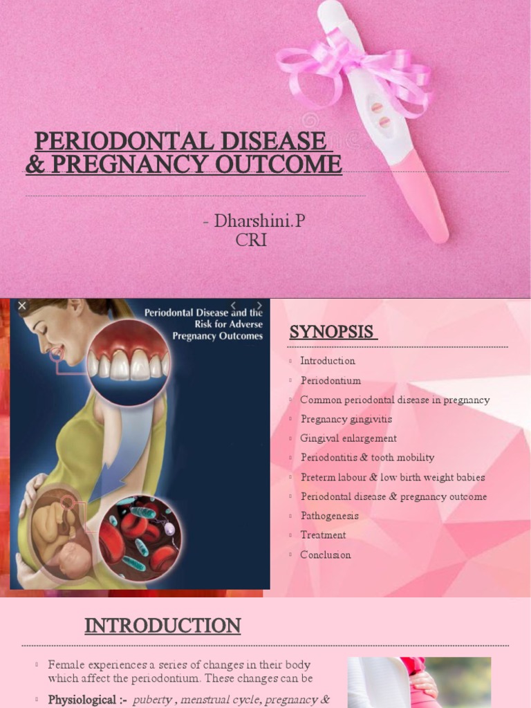 Periodontal Disease and Pregnancy Risks | PDF | Pregnancy | Preterm Birth