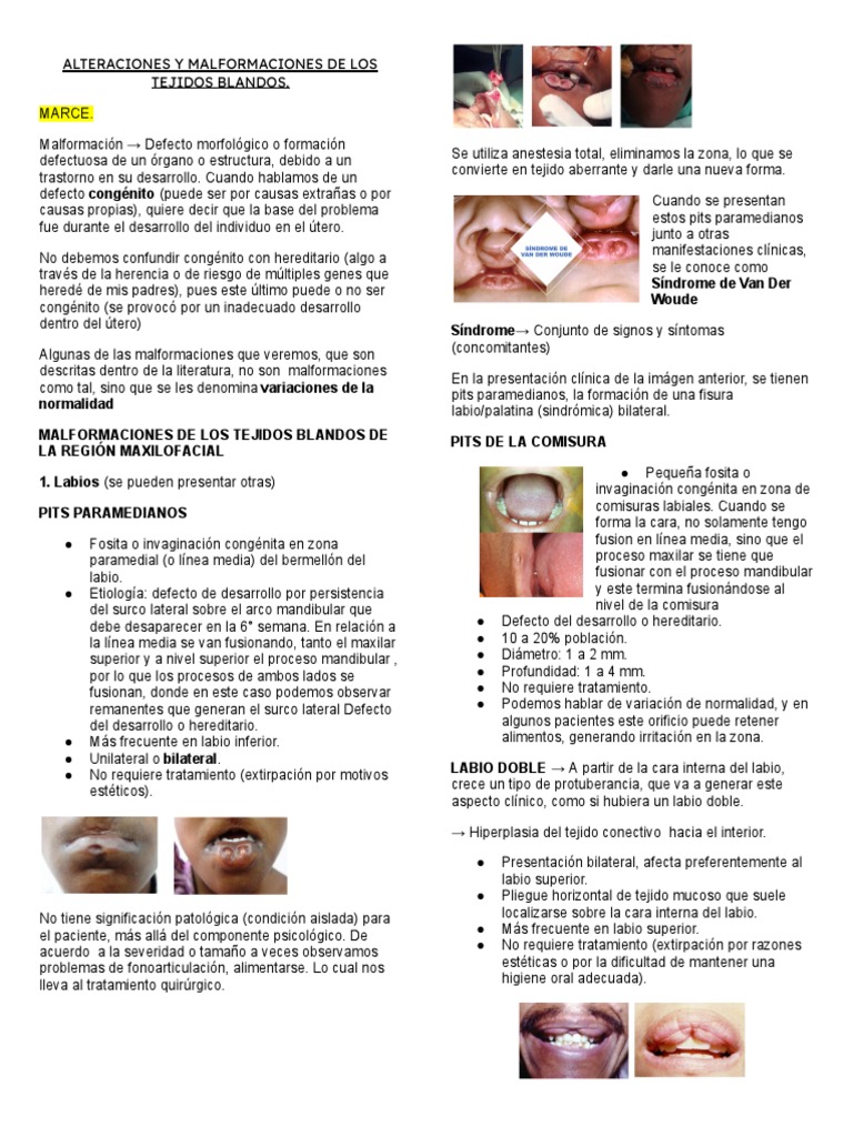 Malformaciones de Los Tejidos Blandos | PDF | Especialidades Medicas | Enfermedades y trastornos