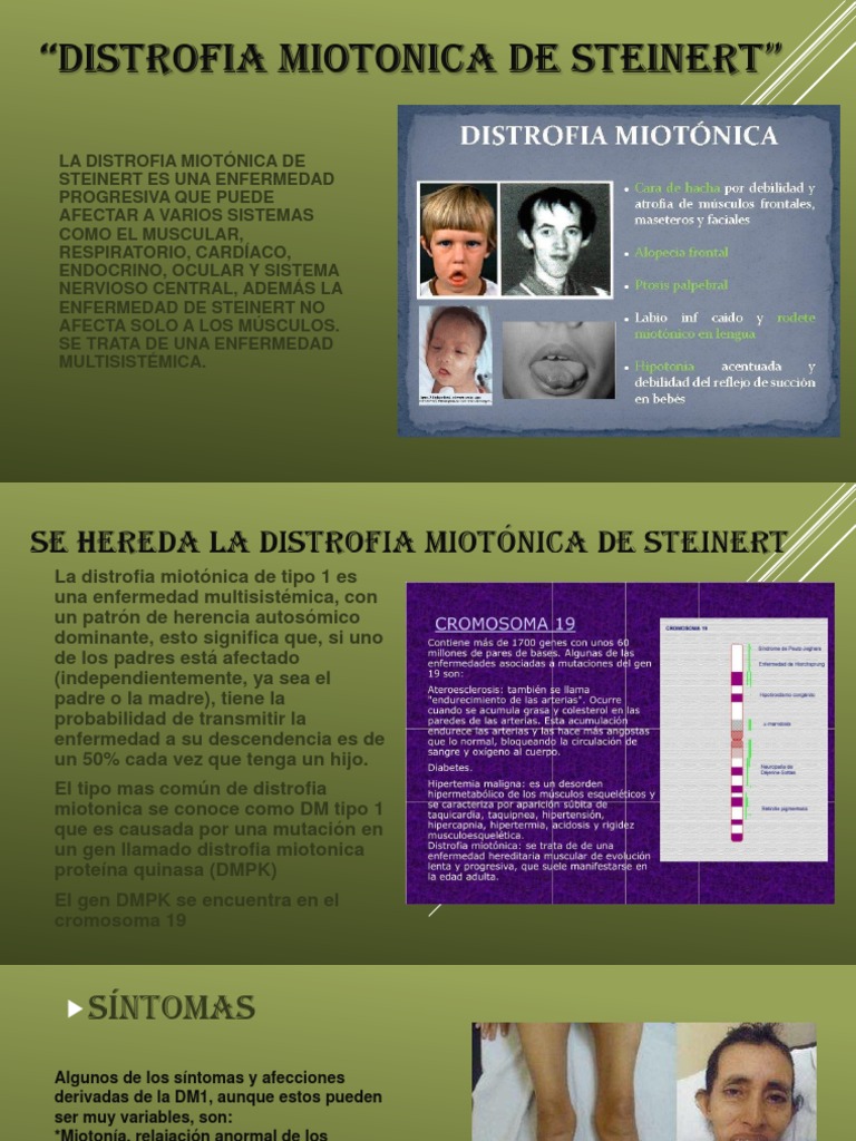 DISTROFIA MIOTONICA DE STEINERT Power Piont | PDF