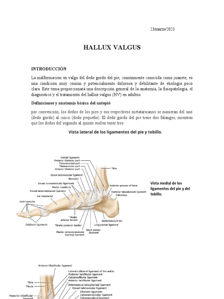 Hallux Valgus: Anatomía y Tratamiento | PDF | Pie | Medicina