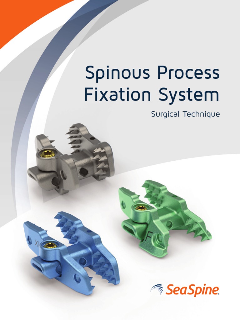 D0000309H Spinous Process Surgical Technique 01-1 | PDF