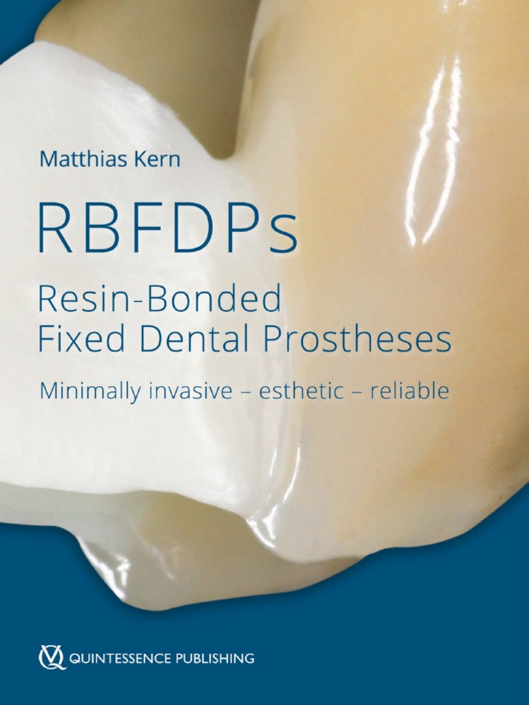 leseprobe_20611_kern_resin-bonded_fixed_dental_prostheses | PDF ...