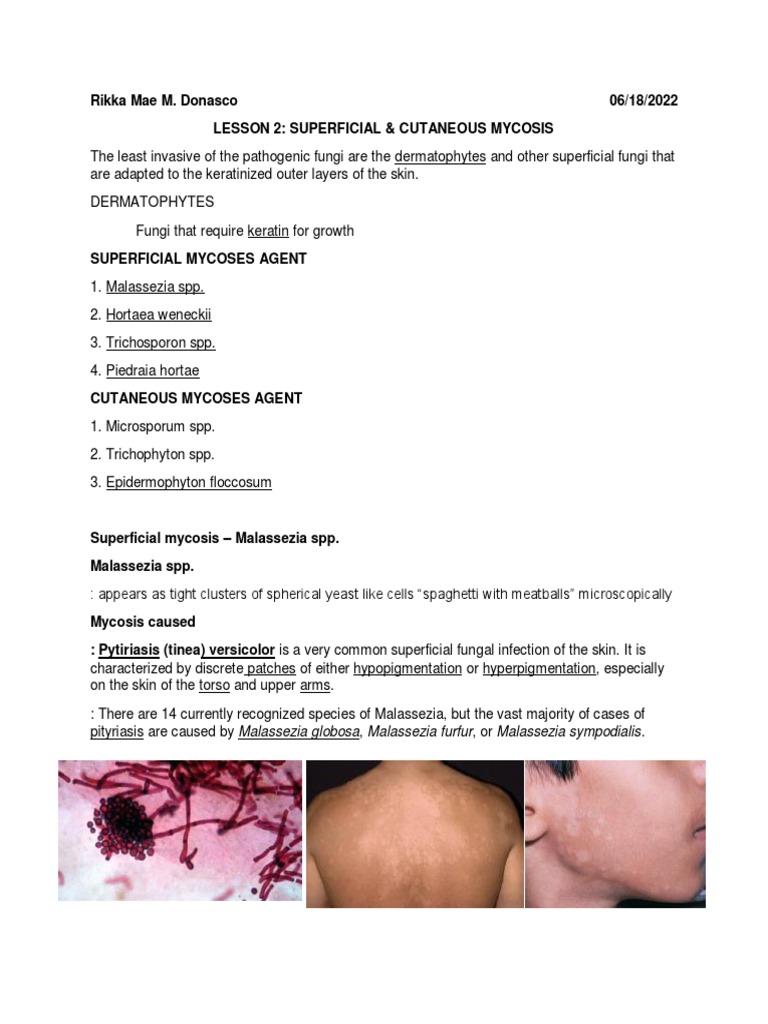 Superficial & Cutaneous Mycosis Guide | PDF