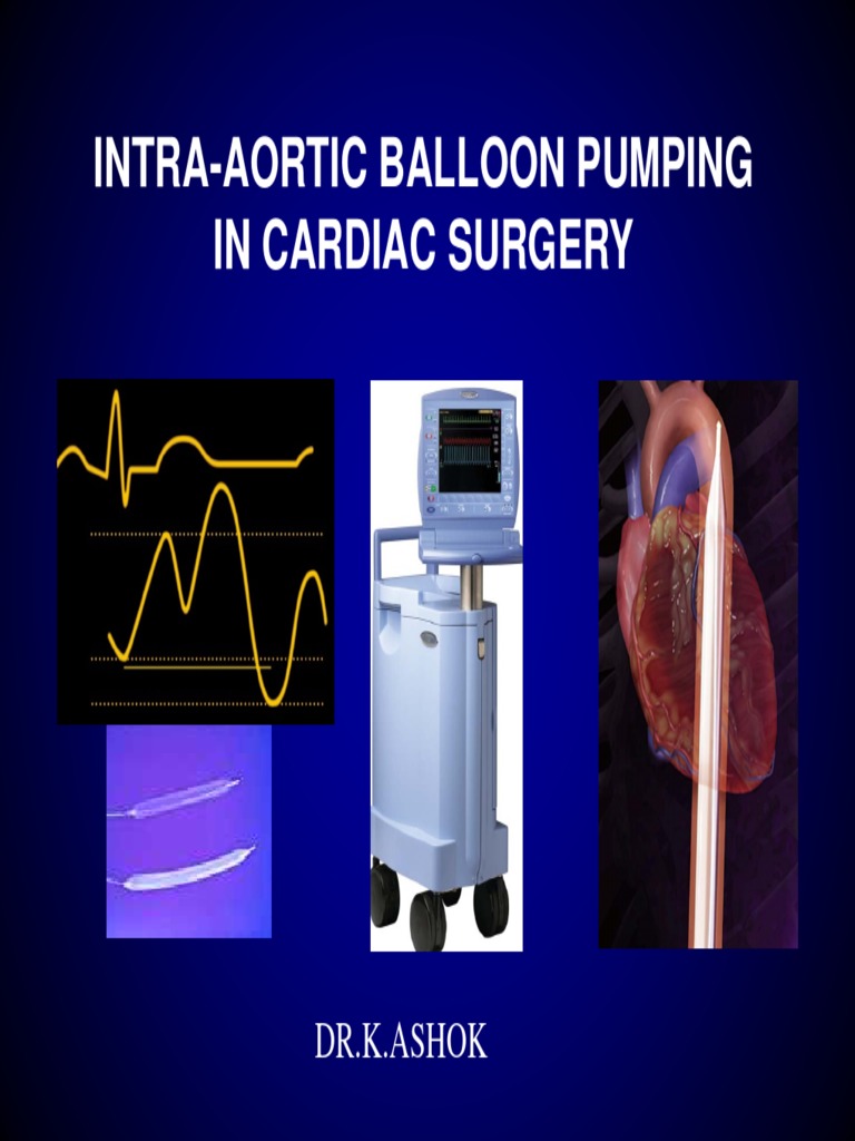 INTRA-AORTIC BALLOON PUMPING IN CARDIAC SURGERY (PDFDrive) | PDF ...