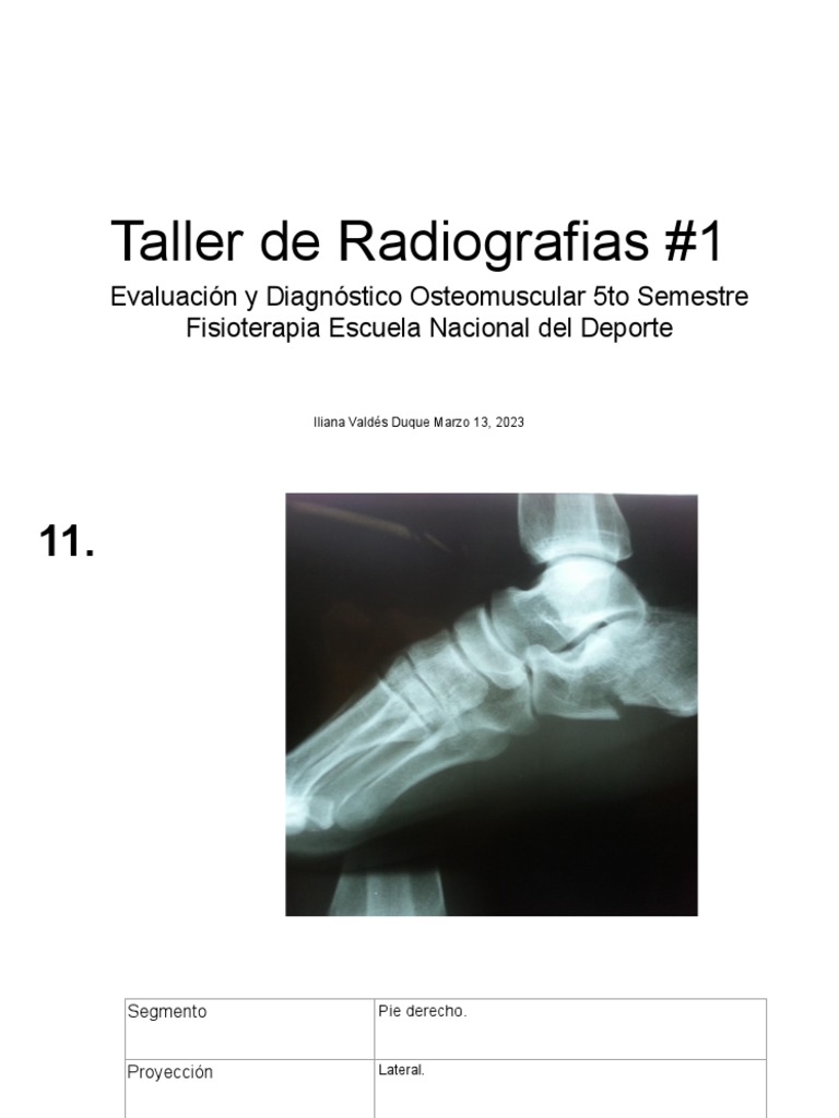 Taller Radiografías #1 2023-1 | PDF | Rodilla | Sistema esquelético
