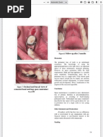 MBT and Roth Torque Values Comparison | PDF | Orthodontics
