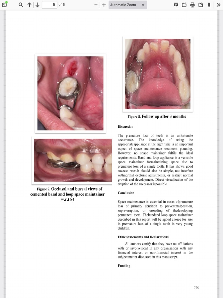 View of Band and Loop A Case Report | PDF | Dentistry Branches | Dental ...