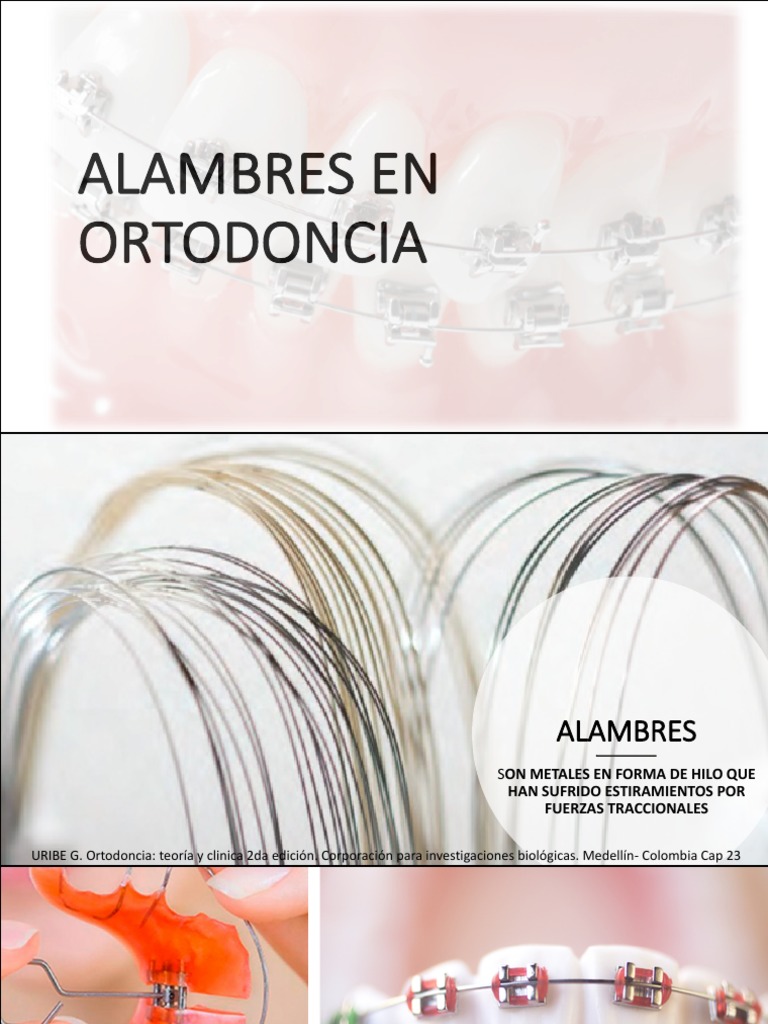 Alambres en Ortodoncia: Tipos y Usos | PDF | Deformación (ingeniería ...