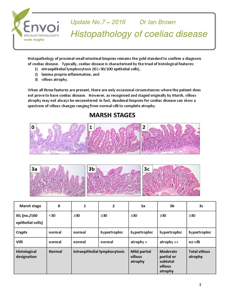 Pathology of Coeliac Disease | PDF | Coeliac Disease | Biopsy