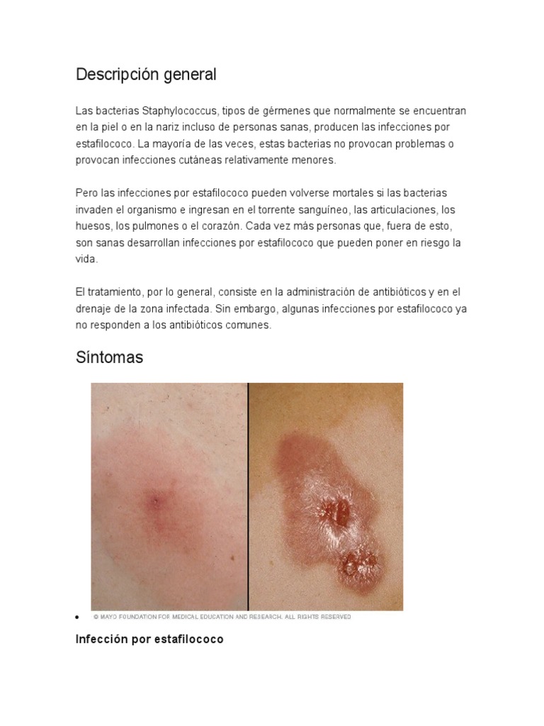 Infecciones Por Estafilococos En La Piel Pdf Staphylococcus Aureus