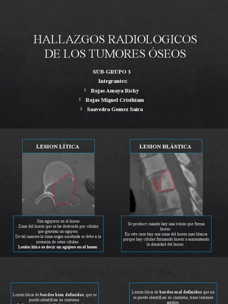 Hallazgos Radiologicos de Los Tumores Óseos Final | PDF | Hueso | Cáncer