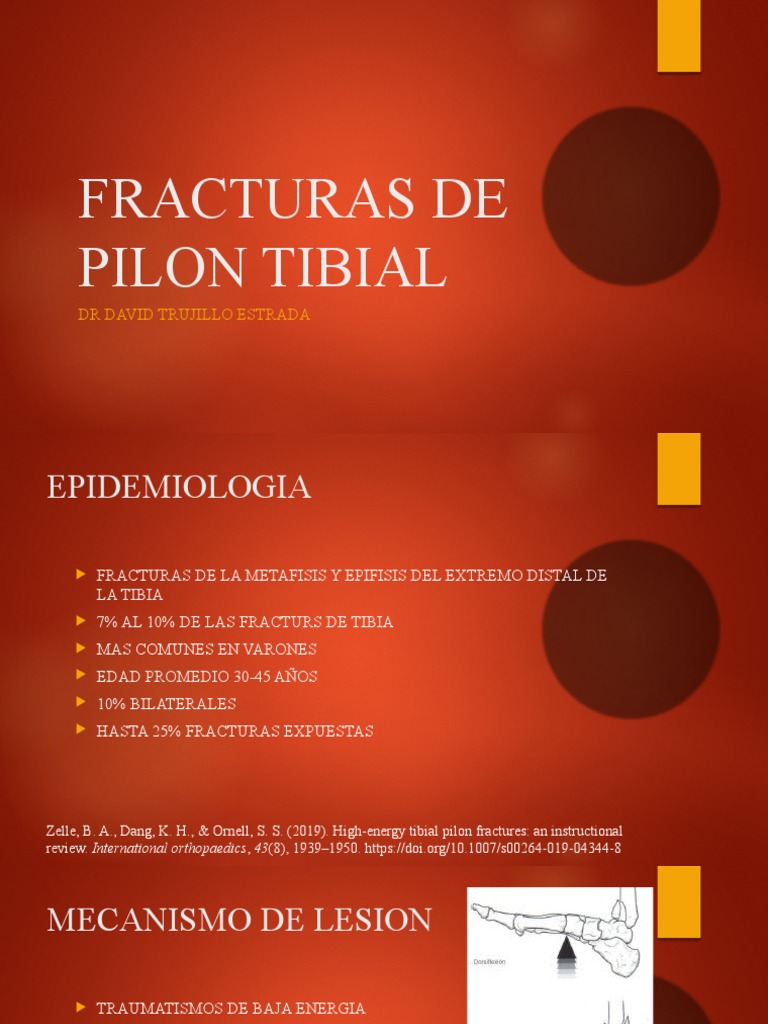 FRACTURAS DE PILON TIBIAL (Autoguardado) | PDF | Surgical Specialties | Pain