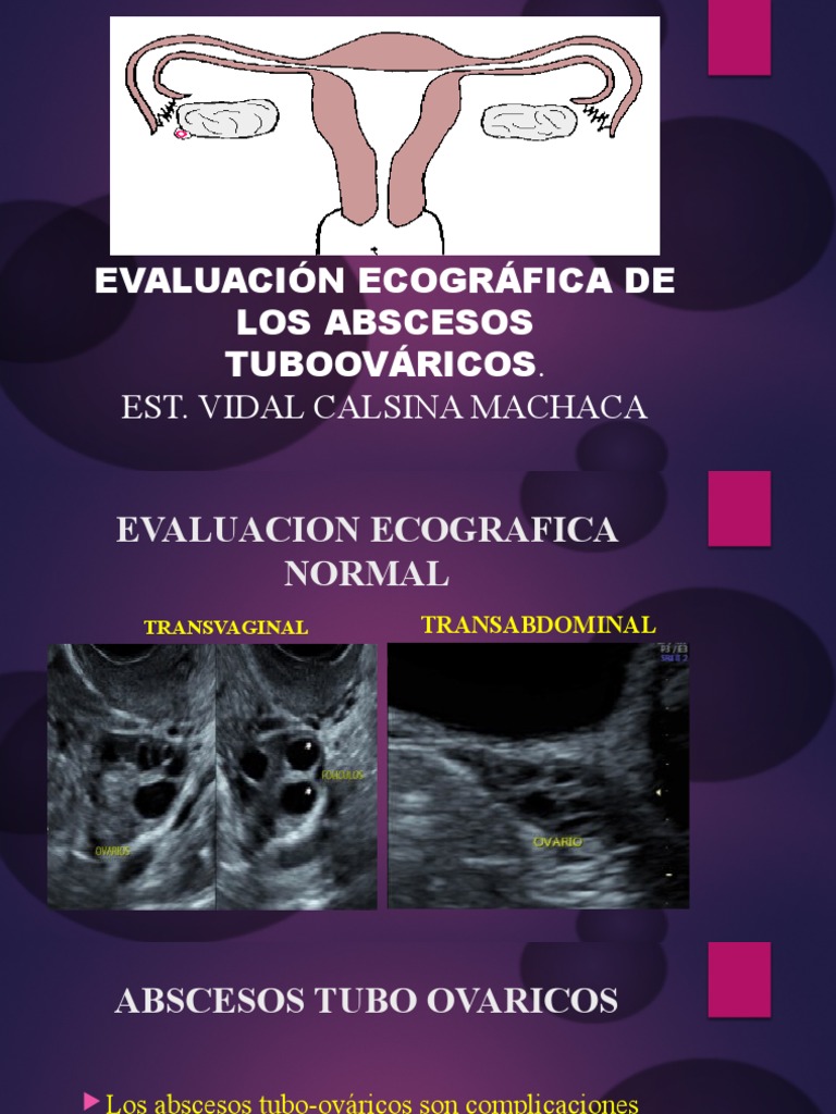 Abscesos Tuboováricos para Presentar | PDF | Ultrasonido médico ...