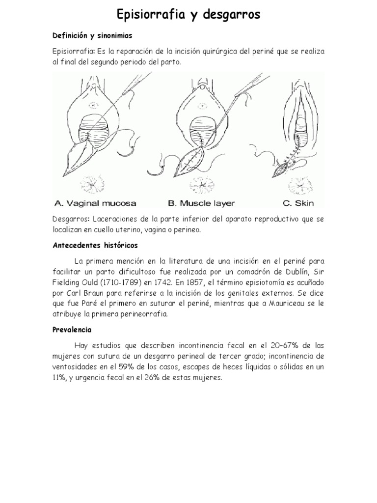 Episiorrafia y Desgarros | PDF | Parto | Causas de la muerte