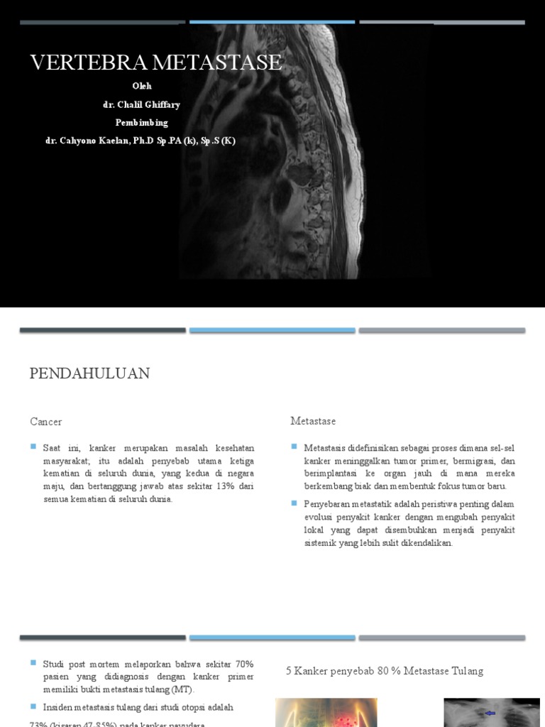 VERTEBRA METASTASE | PDF