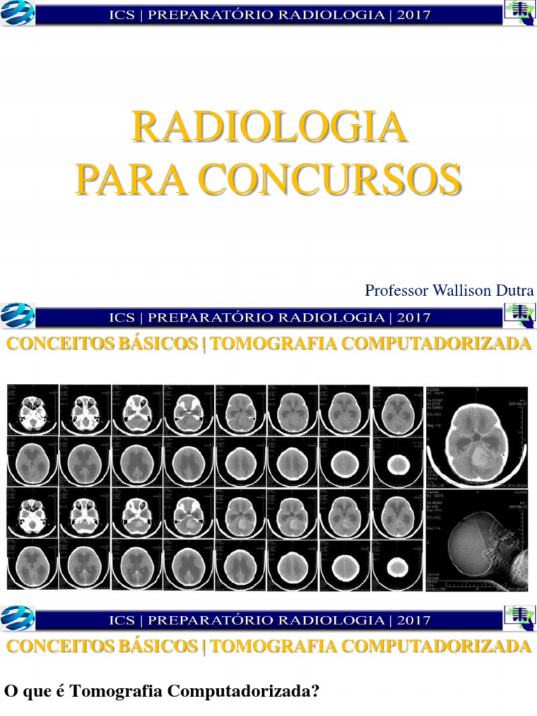 Radiologia para Concursos: Professor Wallison Dutra | PDF | Tomografia computadorizada | Voxel