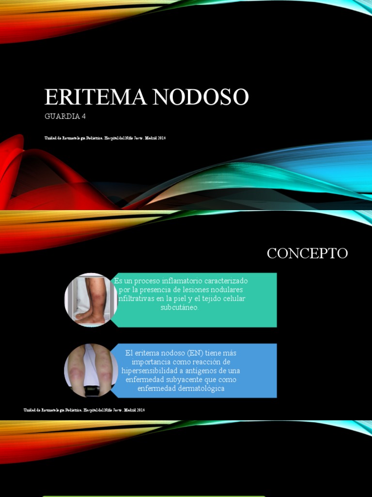 Eritema Nodoso en Pediatria | PDF | Especialidades Medicas | Medicina ...