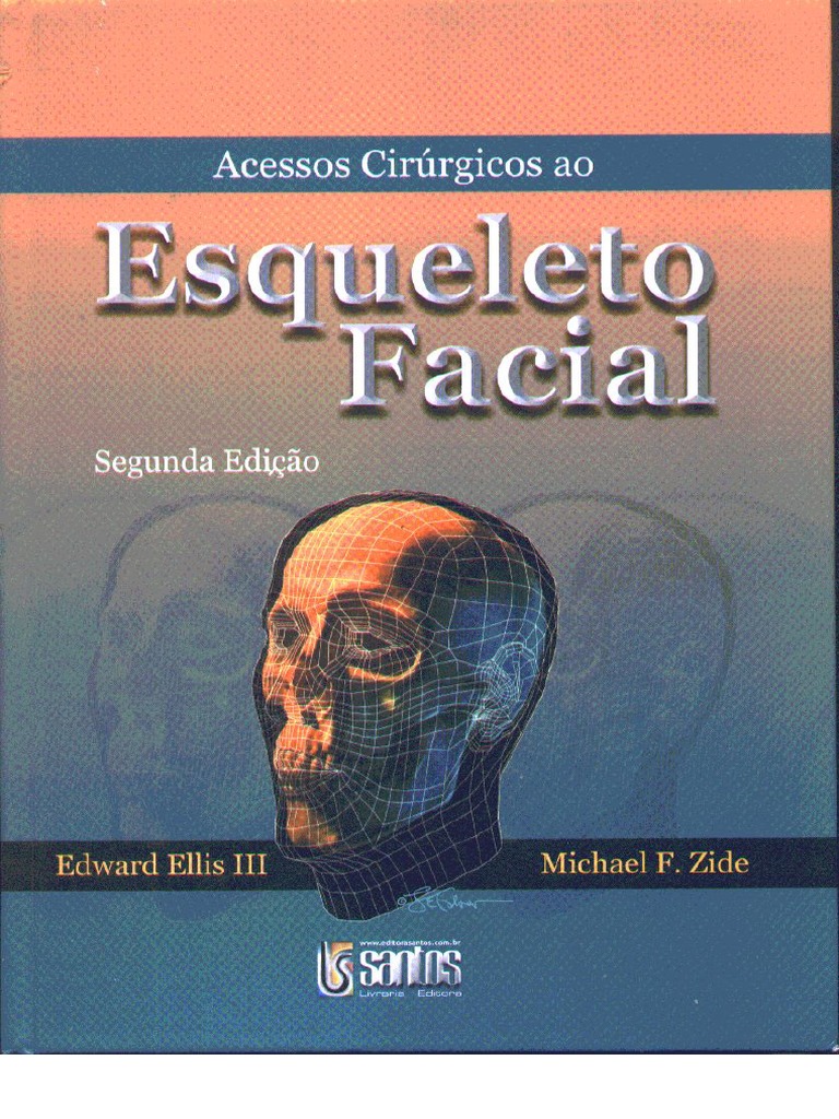 Acessos Cirúrgicos Ao Esqueleto Facial | PDF